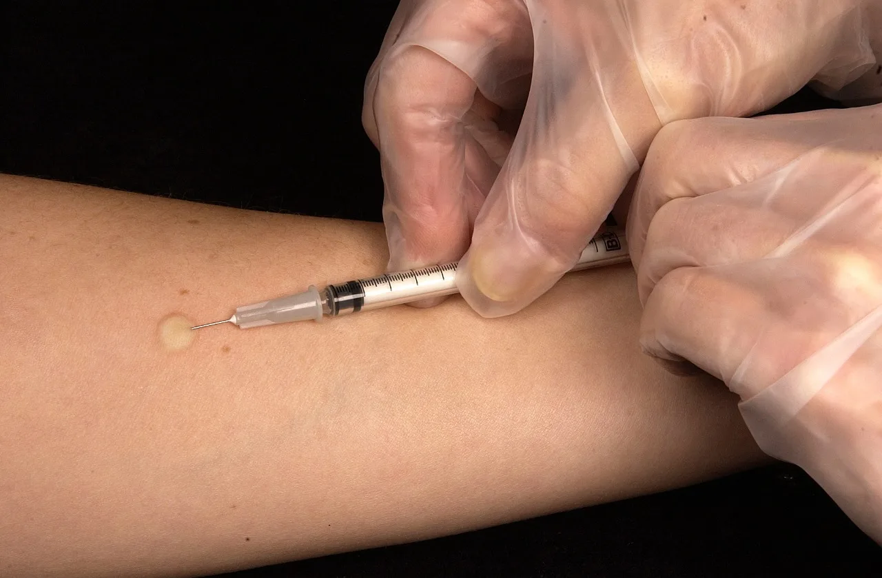 PEMERIKSAAN TES KULIT TUBERKULIN (TST/TUBERKULIN SKIN TEST) PADA WARGA ...